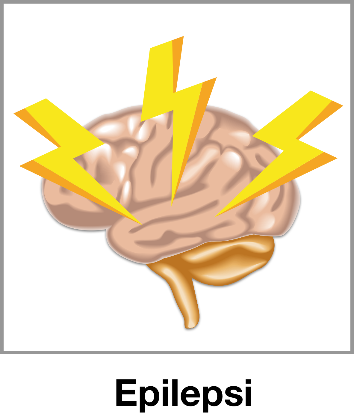 Epilepsi (Sara Hastalığı) - Prof. Dr. Hülya Uzunismail